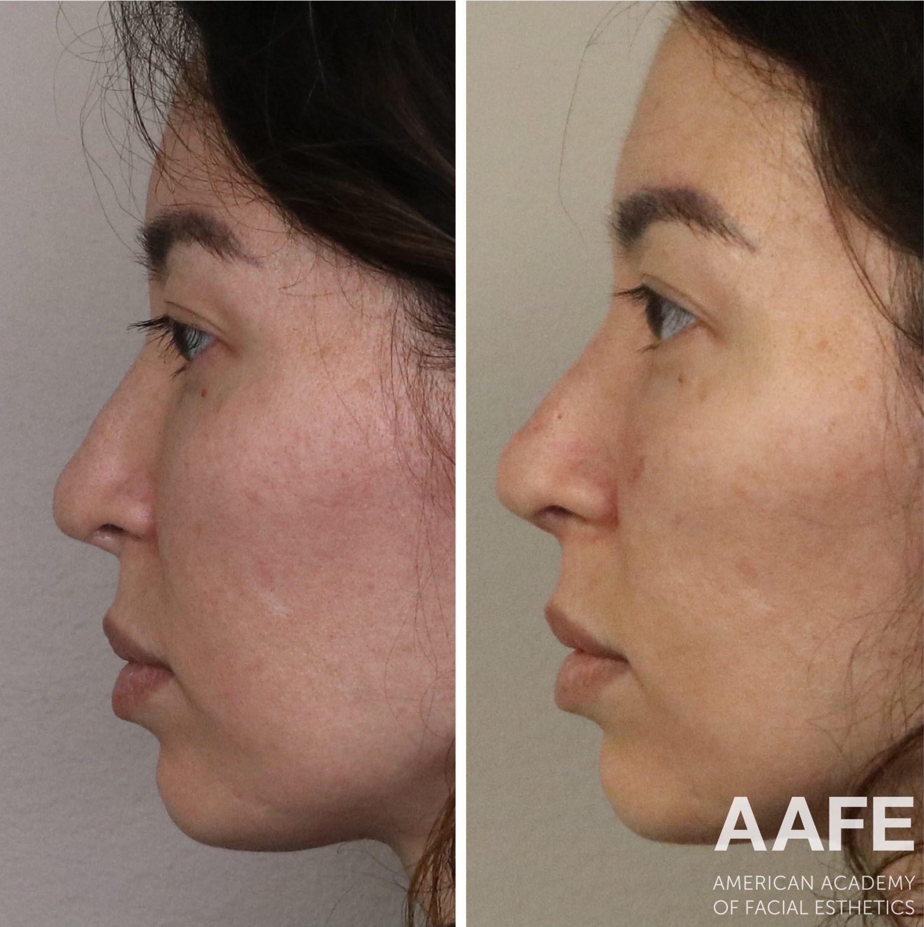Online Training - Courses on Demand - AAFE - American Academy of Facial ...
