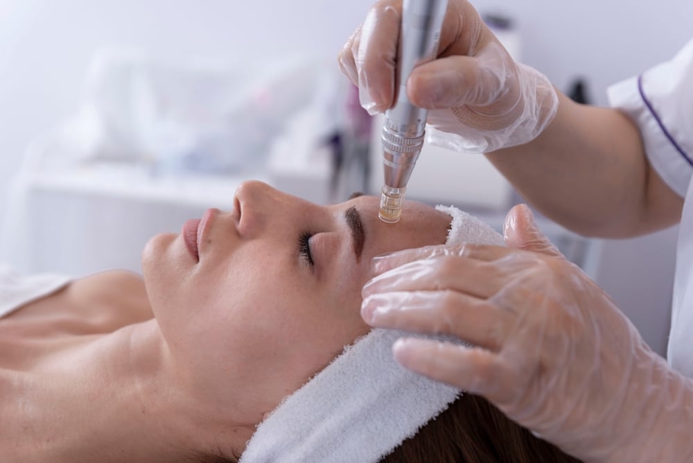 PRP Microneedling: Unlocking Ancient Skincare Secrets - AAFE - American ...
